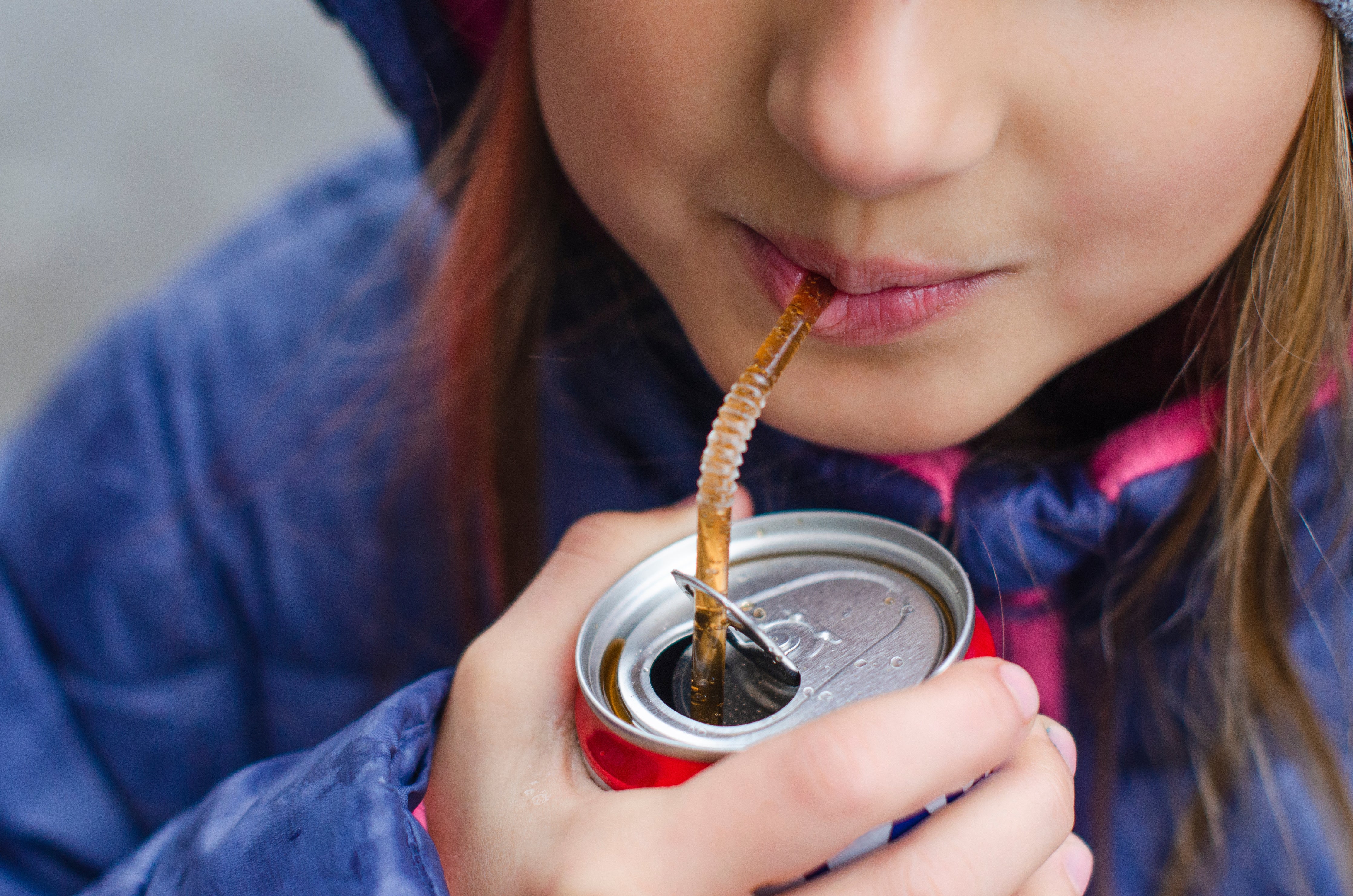 What Causes Tooth Decay? – Fallbrook Dental Care